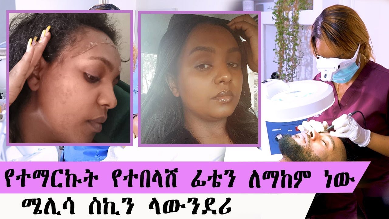 የተማርኩት የተበላሸ ፊቴን ለማከም ነው "ሜሊሳ ስኪን ላውንደሪ" - ወፍ በረር - Wef Berer - እንዝርት ...
