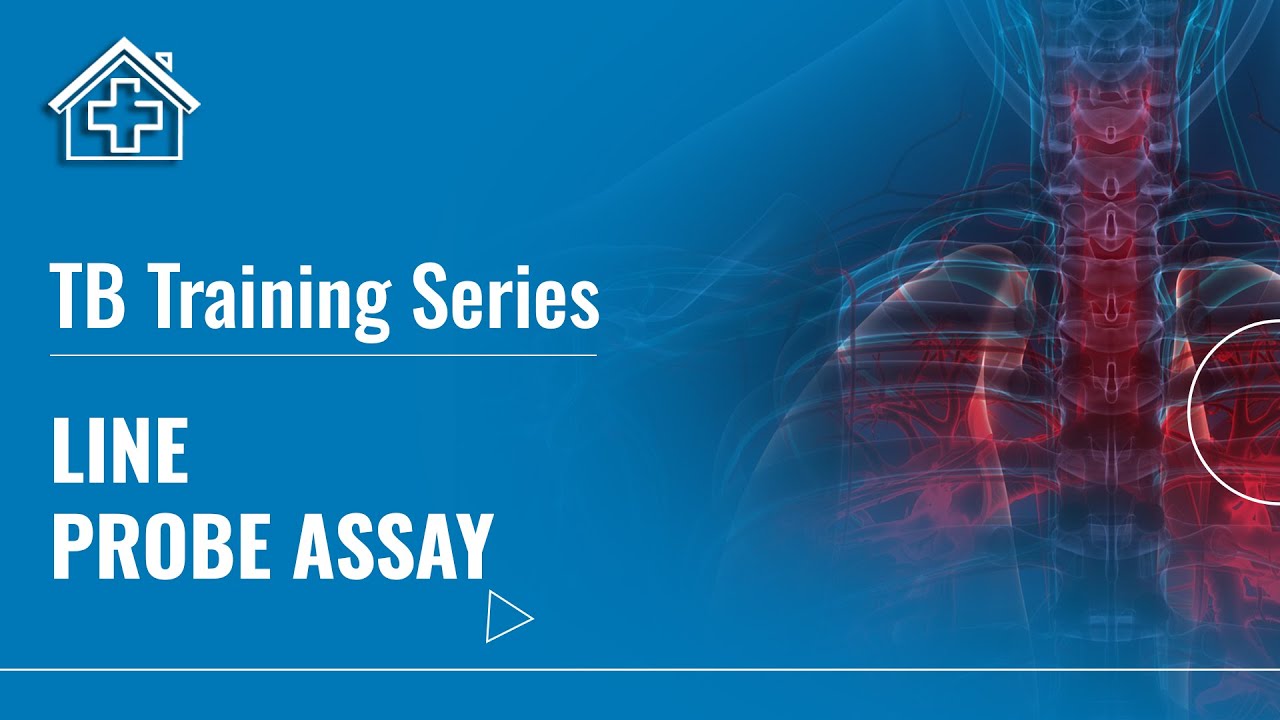 TB Training Film | Line Probe Assay (LPA) – Step-by-Step Laboratory ...