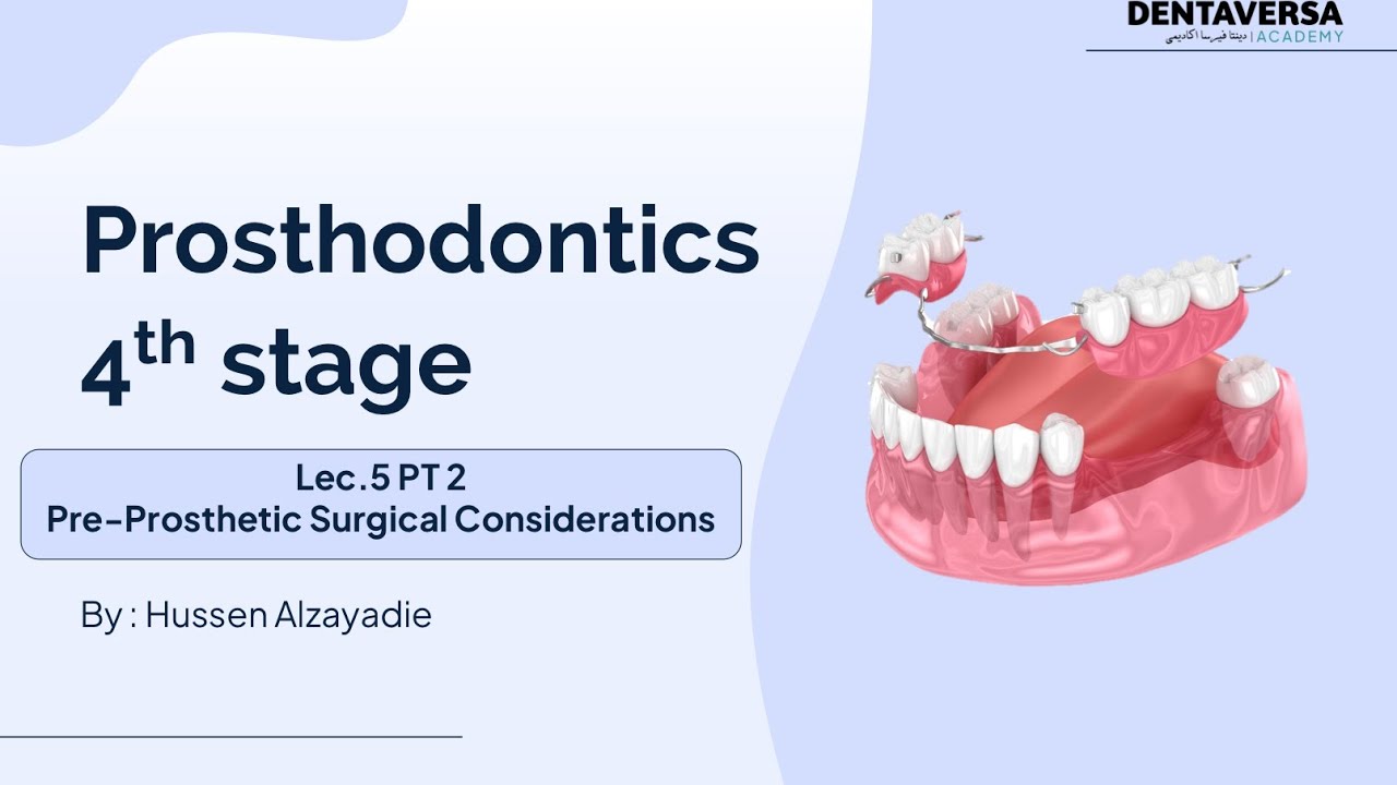 Prosthodontics Stage4 Lec 5 PT2 Pre-prosthetic preparation | DentaVersa ...