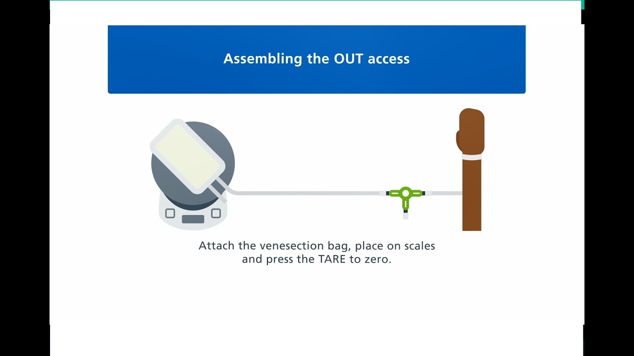 Setting up and Performing a Manual Exchange Red Cell Exchange in Sickle ...
