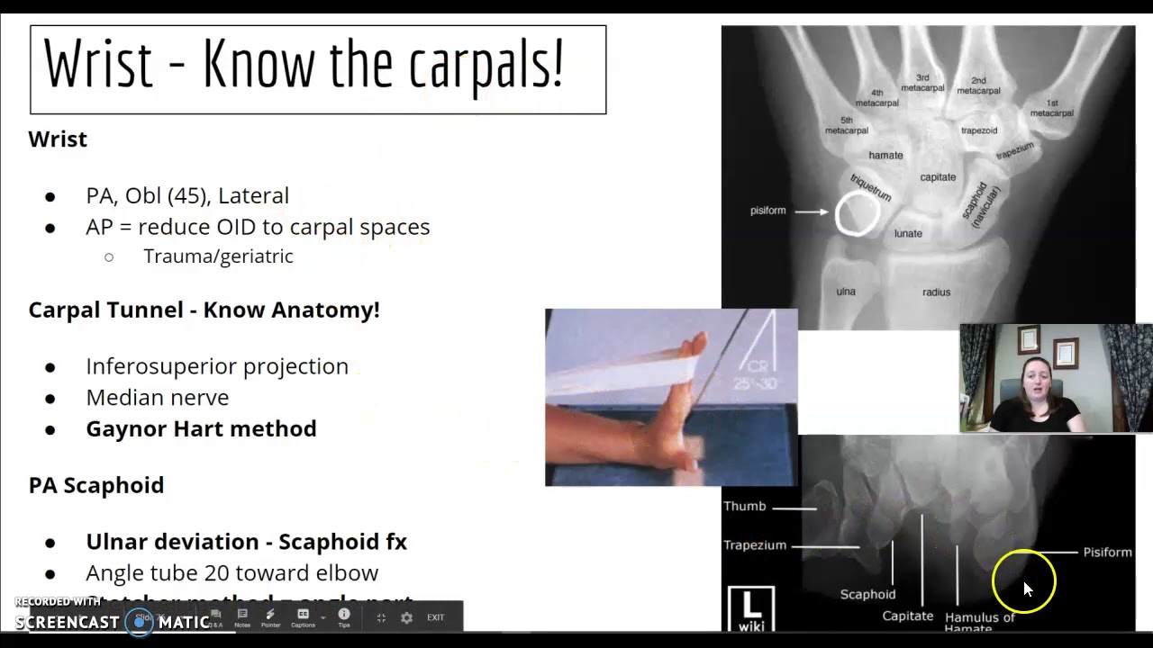ARRT Procedures part # 9 - upper extremity - YouTube