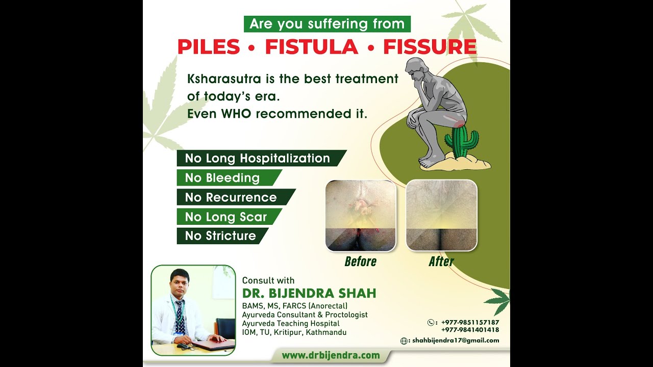 Piles, Fistula, Fissure treatment by Dr Bijendra Shah - YouTube