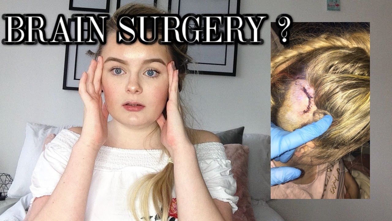 WHERE IVE BEEN,I HAD BRAIN SURGERY - YouTube
