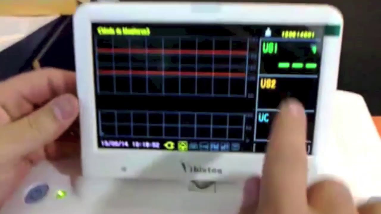 Bistos BT 350 Fetal Monitor DEMO hd - YouTube