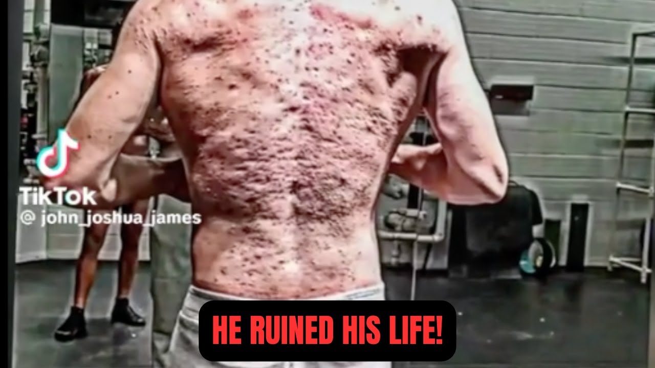 Steroids Can Ruin Your Life - DON'T FALL FOR THE TRAP - YouTube