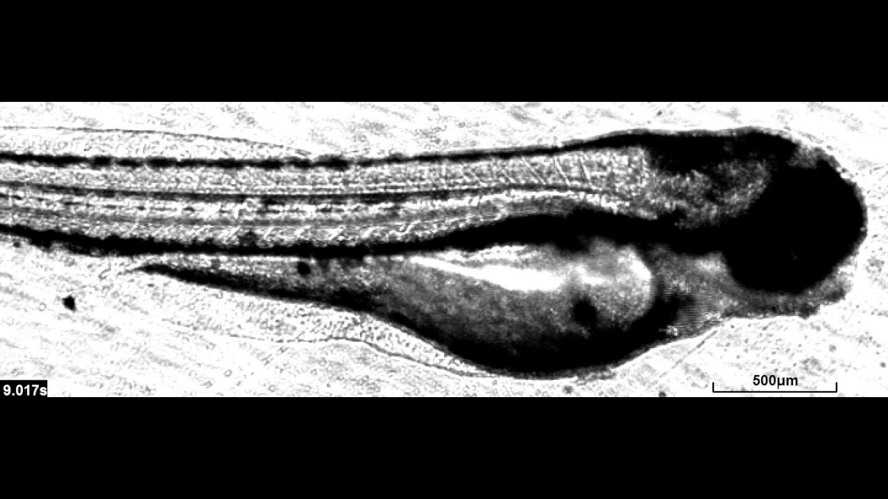 Zebrafish Embryo Blood Circulation - YouTube