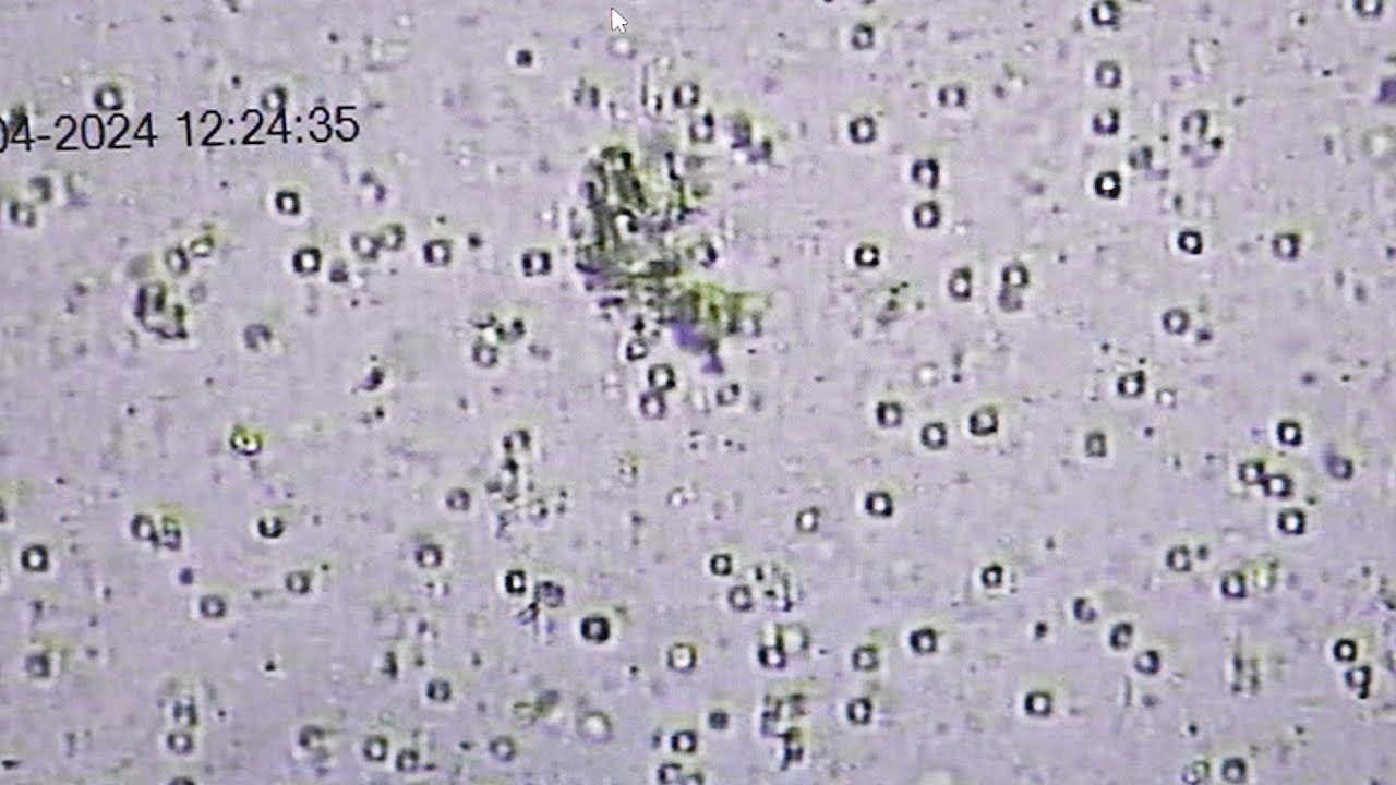 Understanding Micro-TESE | A Solution for Male Infertility ...