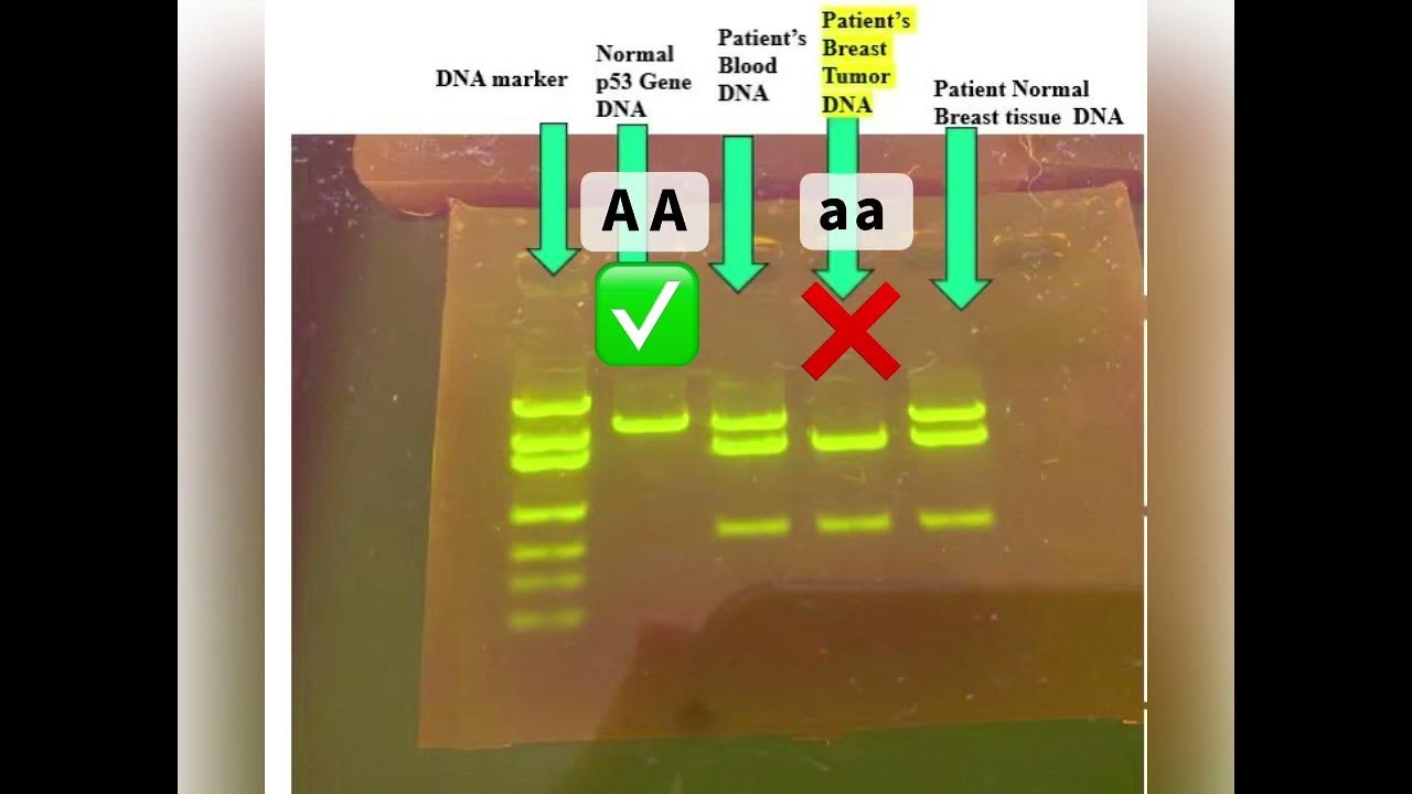 How to analyze gene mutations using Gel Electrophoresis - YouTube