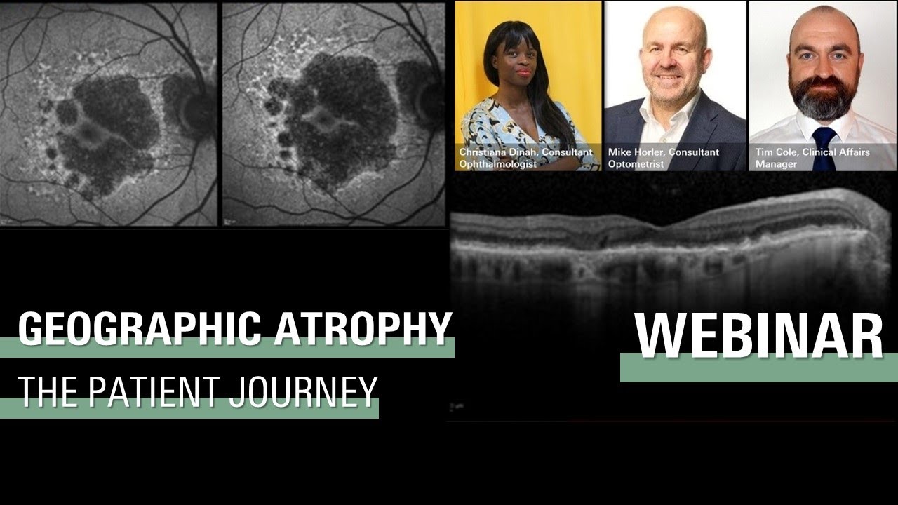 Geographic Atrophy - The Patient Journey (April 2024) - YouTube