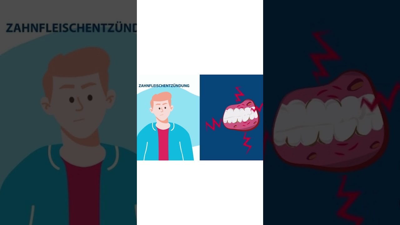 Was sind die Ursachen einer Mundschleimhautentzündung (Stomatitis ...