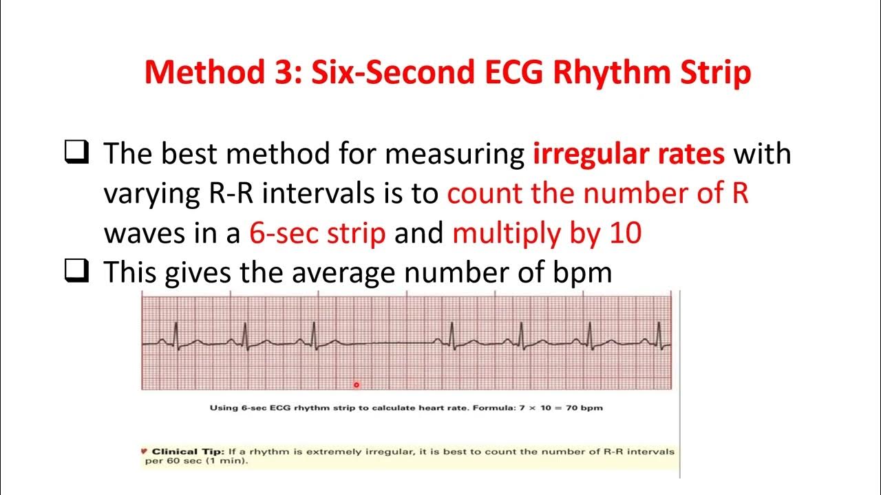 ECG part two - YouTube