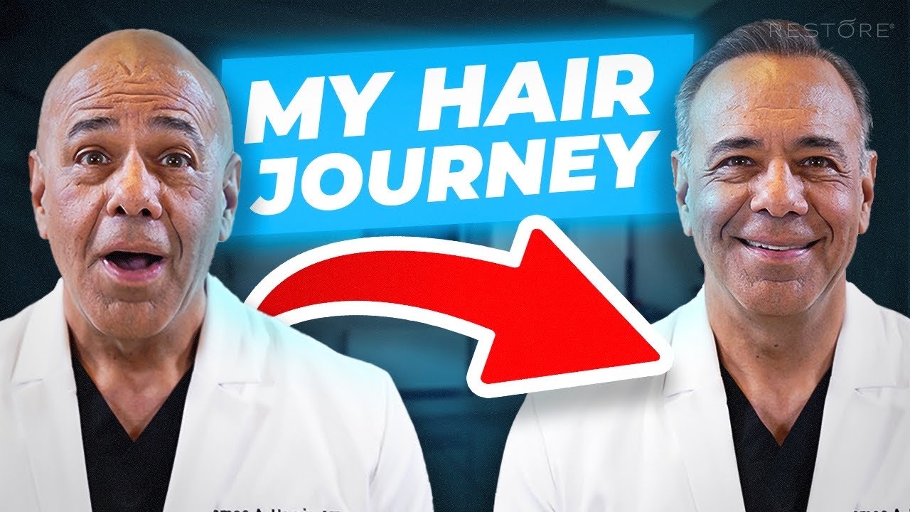 Dr Jim Harris Gives His Hair Restoration Story - YouTube