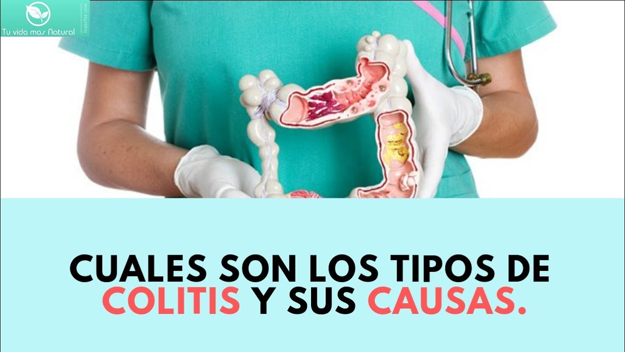 Los Tipos de Colitis y sus Causas - YouTube