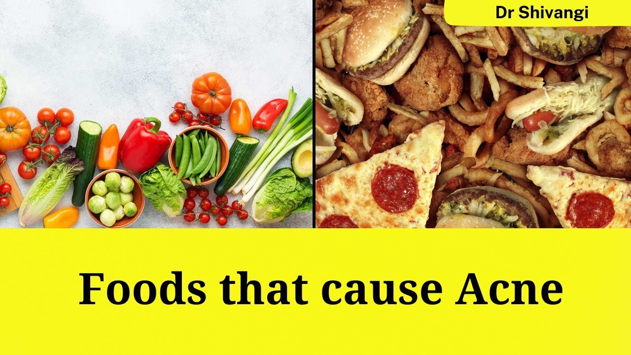 Foods That Cause Cystic Acne – Unmasking Cystic Acne – QEKAE
