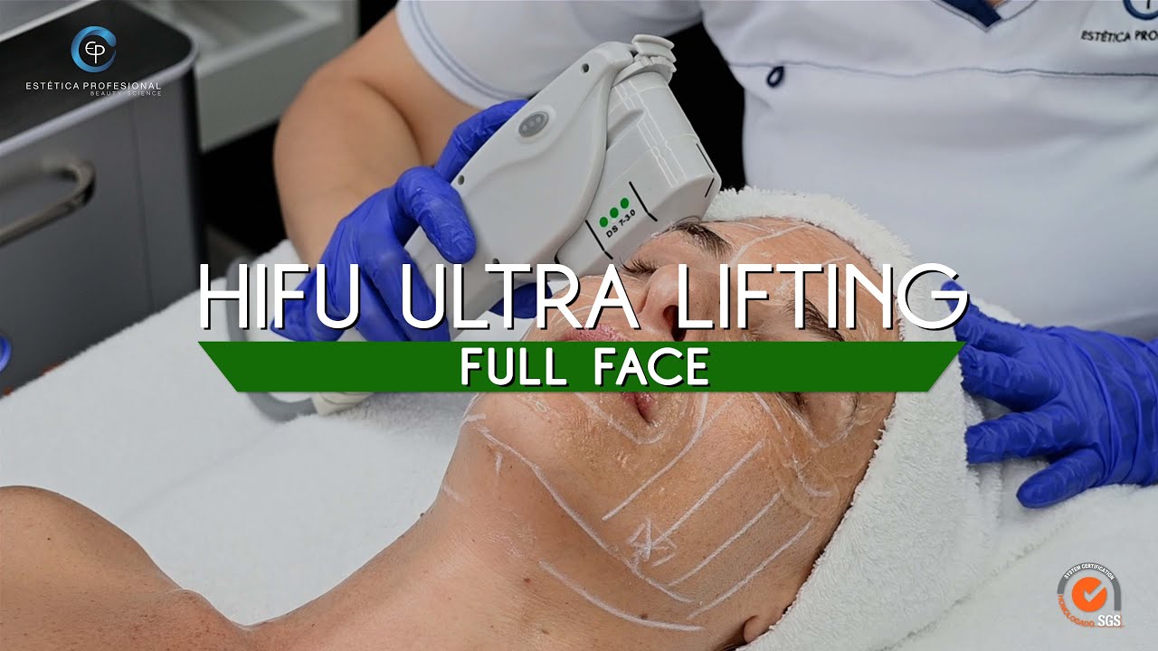HIFU ULTRALIFITING FULL FACE | EP ESTÉTICA PROFESIONAL - YouTube