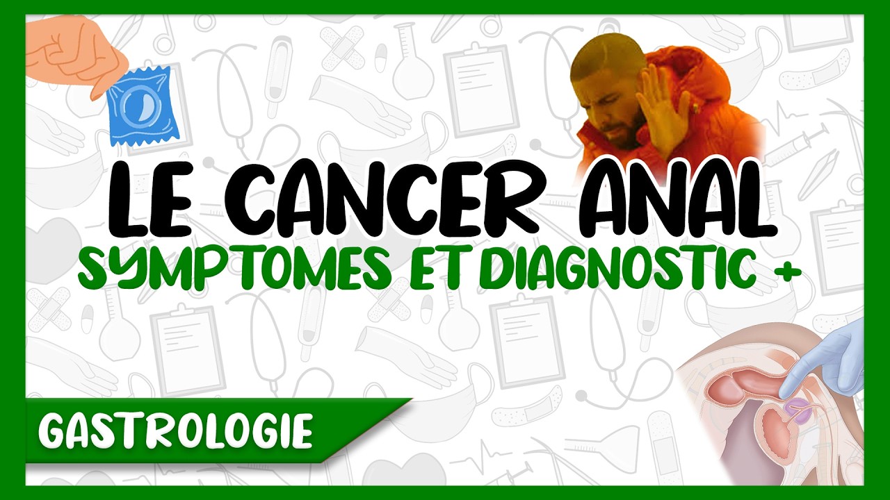 Les Symptômes et Le Diagnostic Positif Du CANCER DE L'ANUS (Clinique ...
