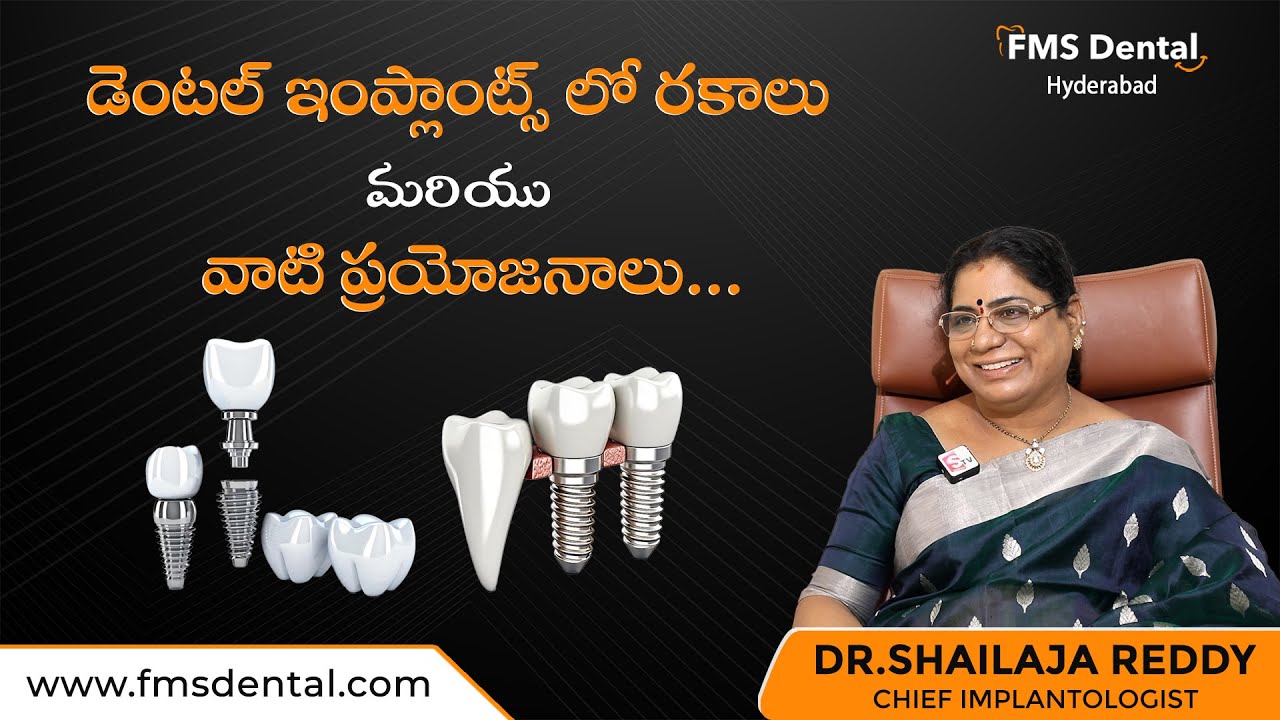 డెంటల్ ఇంప్లాంట్లు జీవితకాలం ఉంటాయా? | Dr.Shailaja Reddy | FMS Dental ...