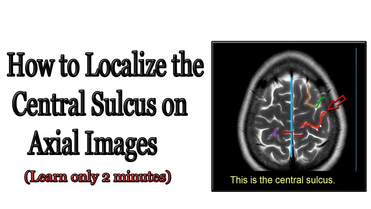 Central Sulcus