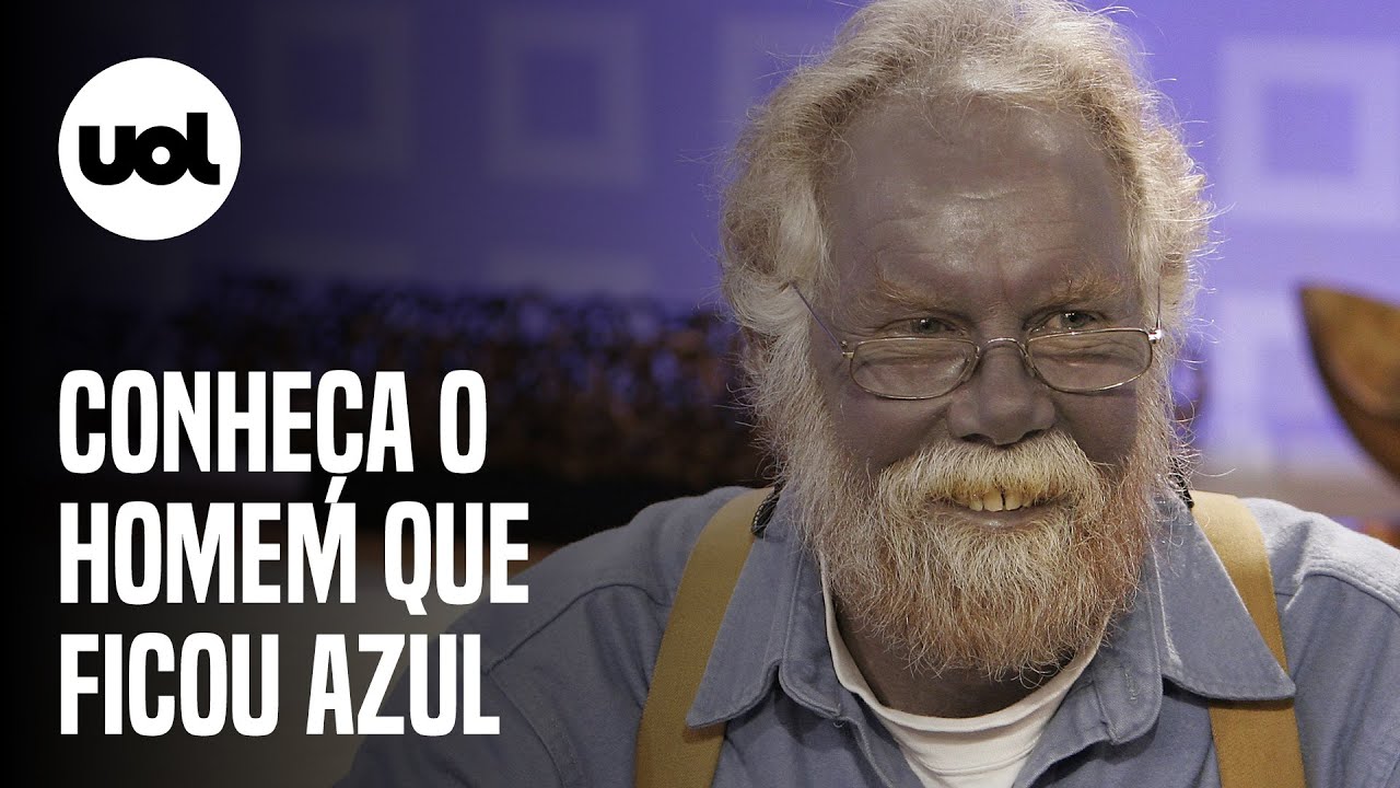 Entenda o caso do "Papai Smurf", homem que ficou com a pele azul - YouTube