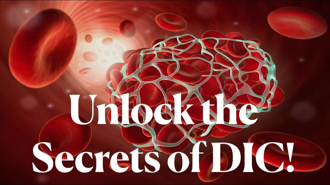 The Hidden Truth About DIC: What Every Medical Professional Needs to ...