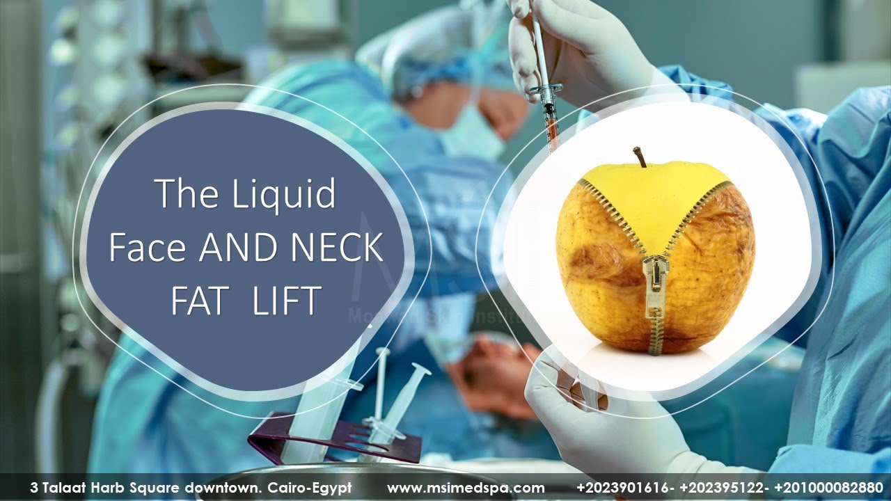 THE LIQUID FACE LIFT. THREE. FAT INJECTION RESULTS (before and after ...