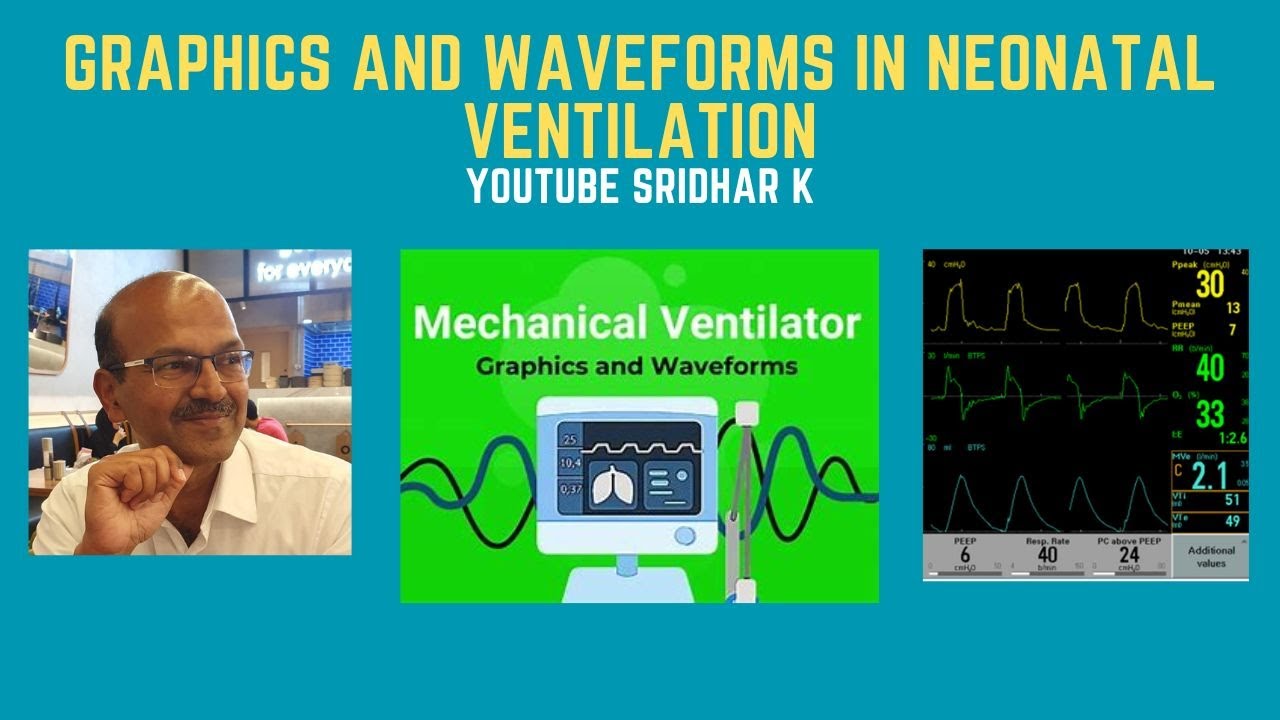 Graphics l Waveforms l Neonatal ventilation #ventilation #graphics ...