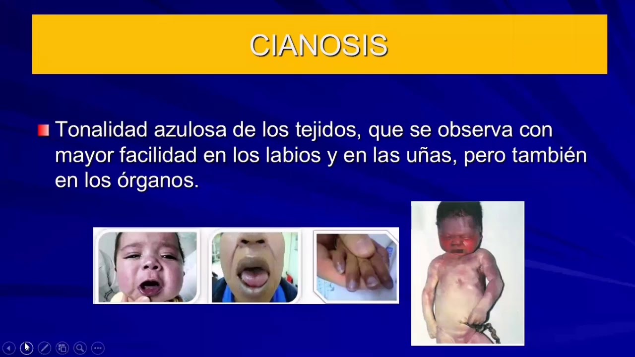 Asfixias pt1 HD - YouTube