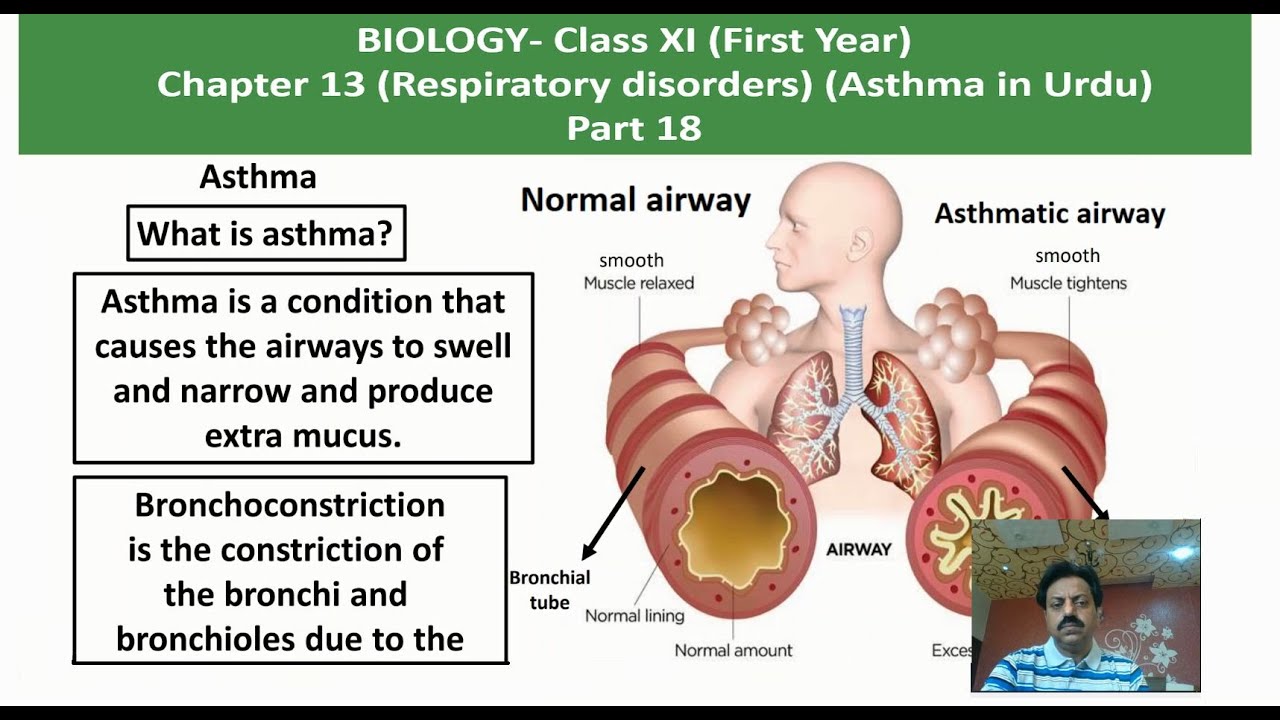 Disorders Of Respiratory Tract Asthma In Urdu First Year disorders-of-respiratory-tract-asthma-in-urdu-first-year
