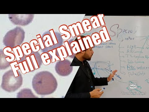 Special Smear|Procedure of Special Smear - YouTube