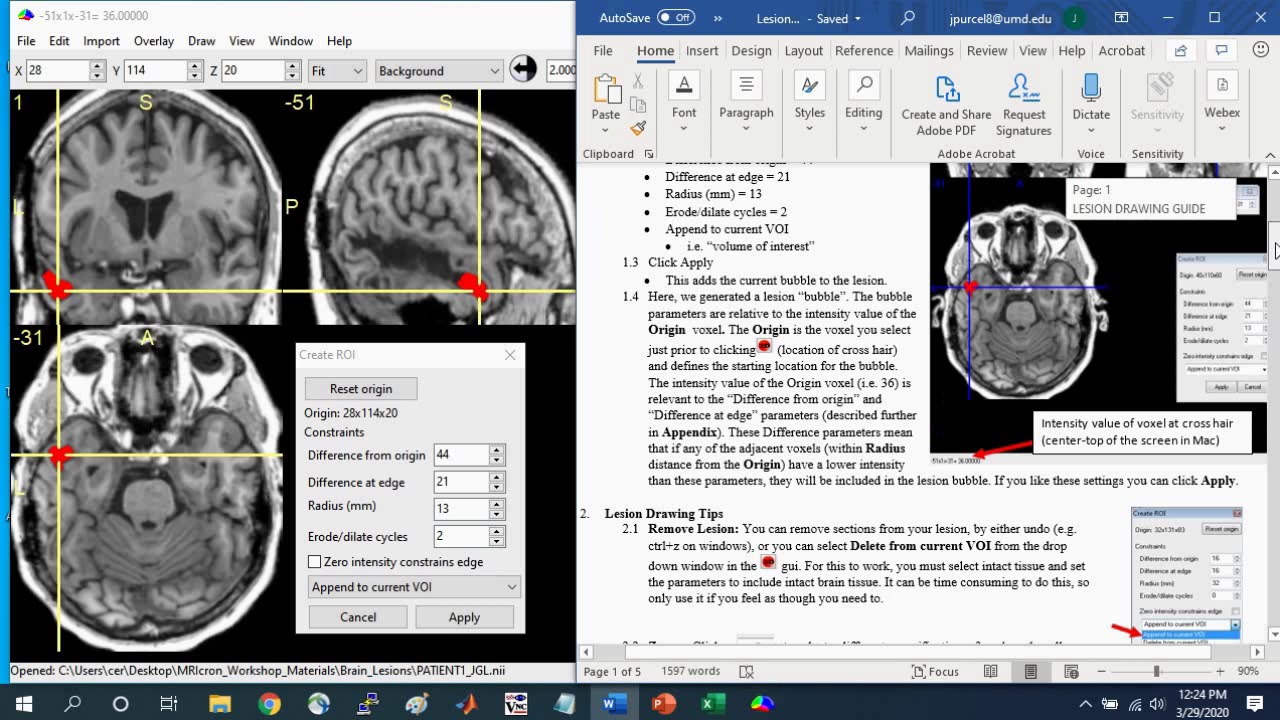 Intro to Lesion Drawing with MRIcron Part1 - YouTube