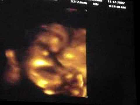Emily's 16 week 3D/4D Ultrasound - YouTube