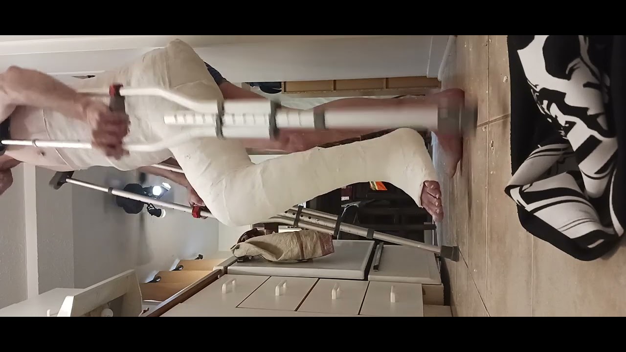 first real hip spica cast - YouTube