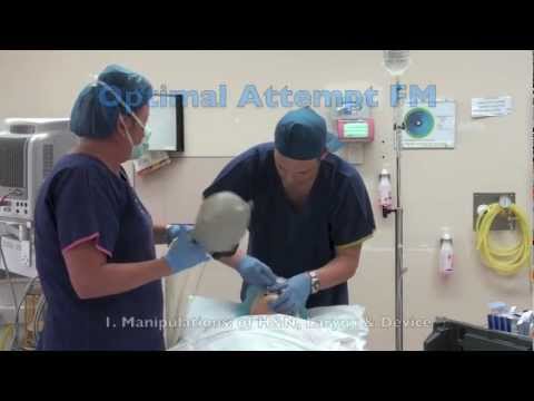 Vortex in Action, Pt 2: Elective Intubation in OT - YouTube