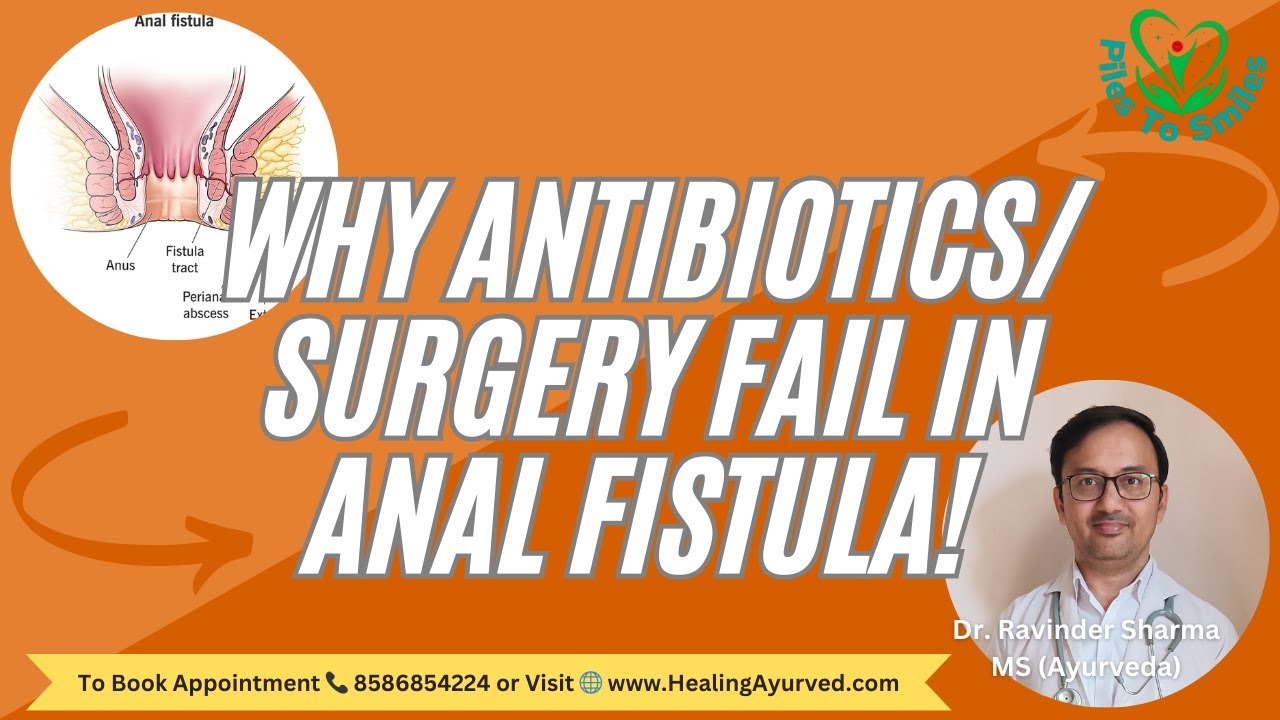 Why antibiotics & surgery fail in fistula | Why stool incontinence is ...