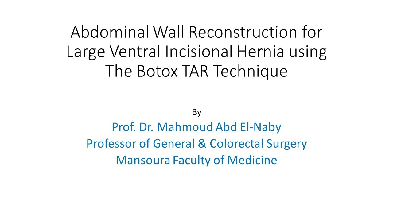 Abdominal Wall Reconstruction for Large Ventral Incisional Hernia using ...