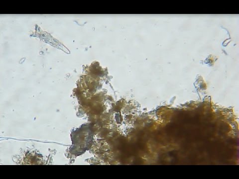 Pond life under microscope - YouTube