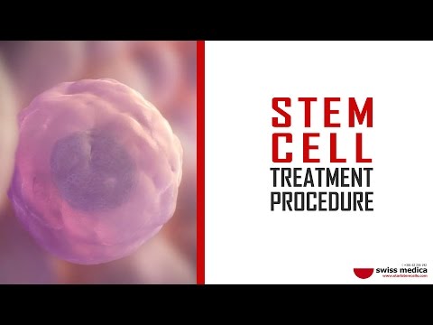 Stem Cell Treatment Procedure