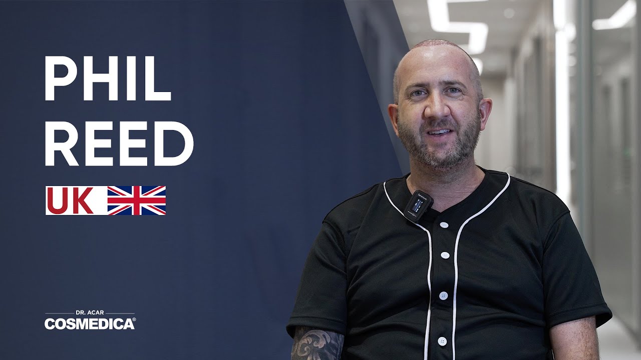 Phil Reed Hair Transplant Review | Dr. Acar | Cosmedica Clinic - YouTube