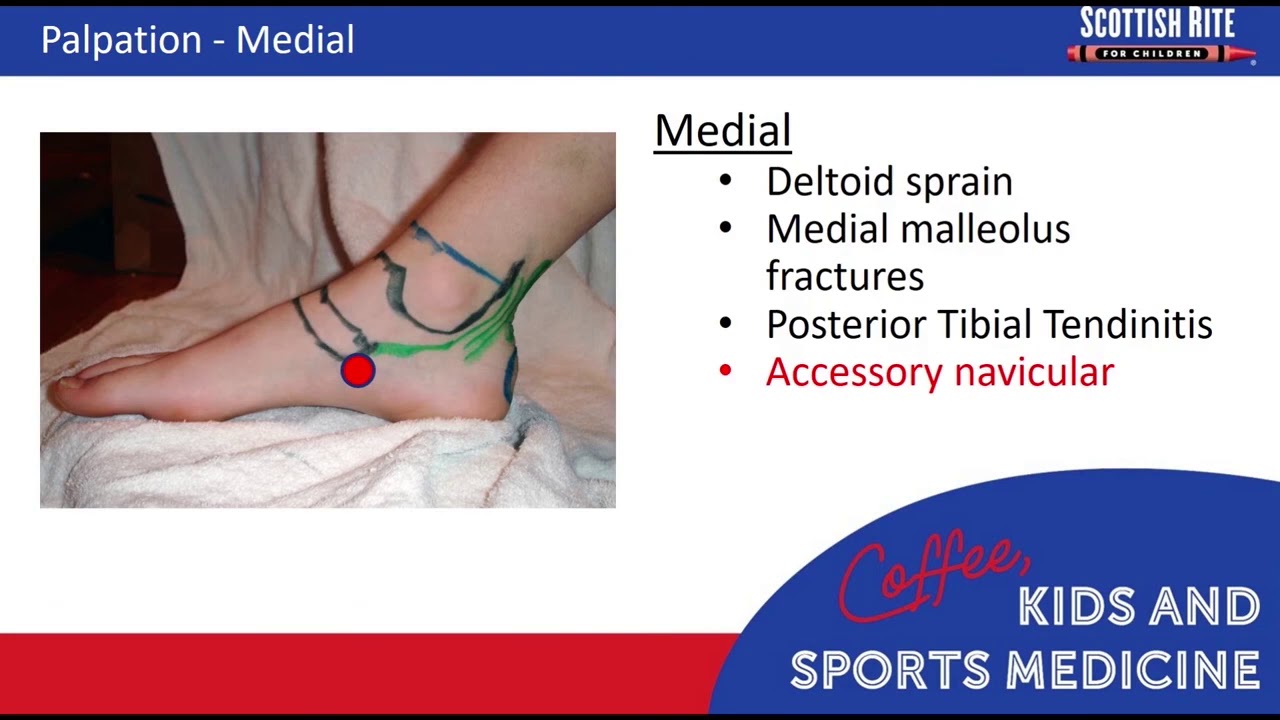Coffee, Kids and Sports Medicine – Adolescent and Pediatric Ankle Exam ...