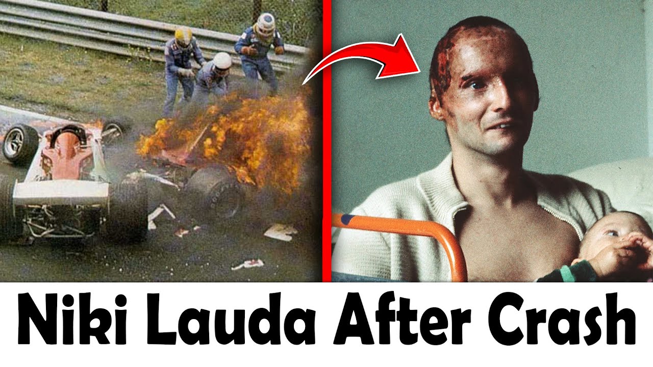 Niki Lauda Crash in Nürburgring Accident | Niki Lauda’s Face Before and ...