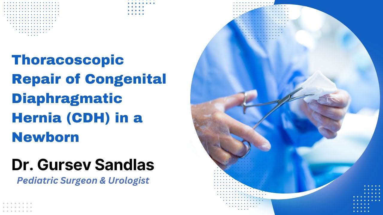 Thoracoscopic Repair of Congenital Diaphragmatic Hernia (CDH) in a ...