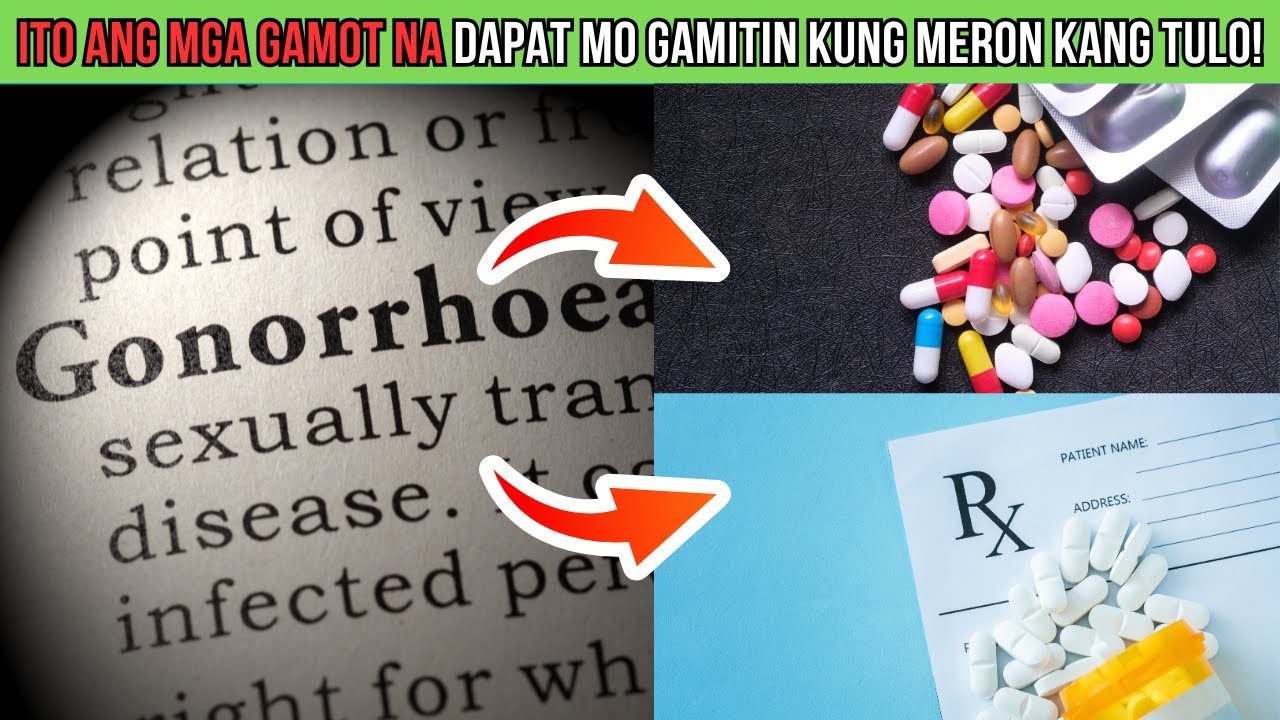 TOP 10 na Pinaka mabisang gamot sa TULO o GONORRHEA - YouTube