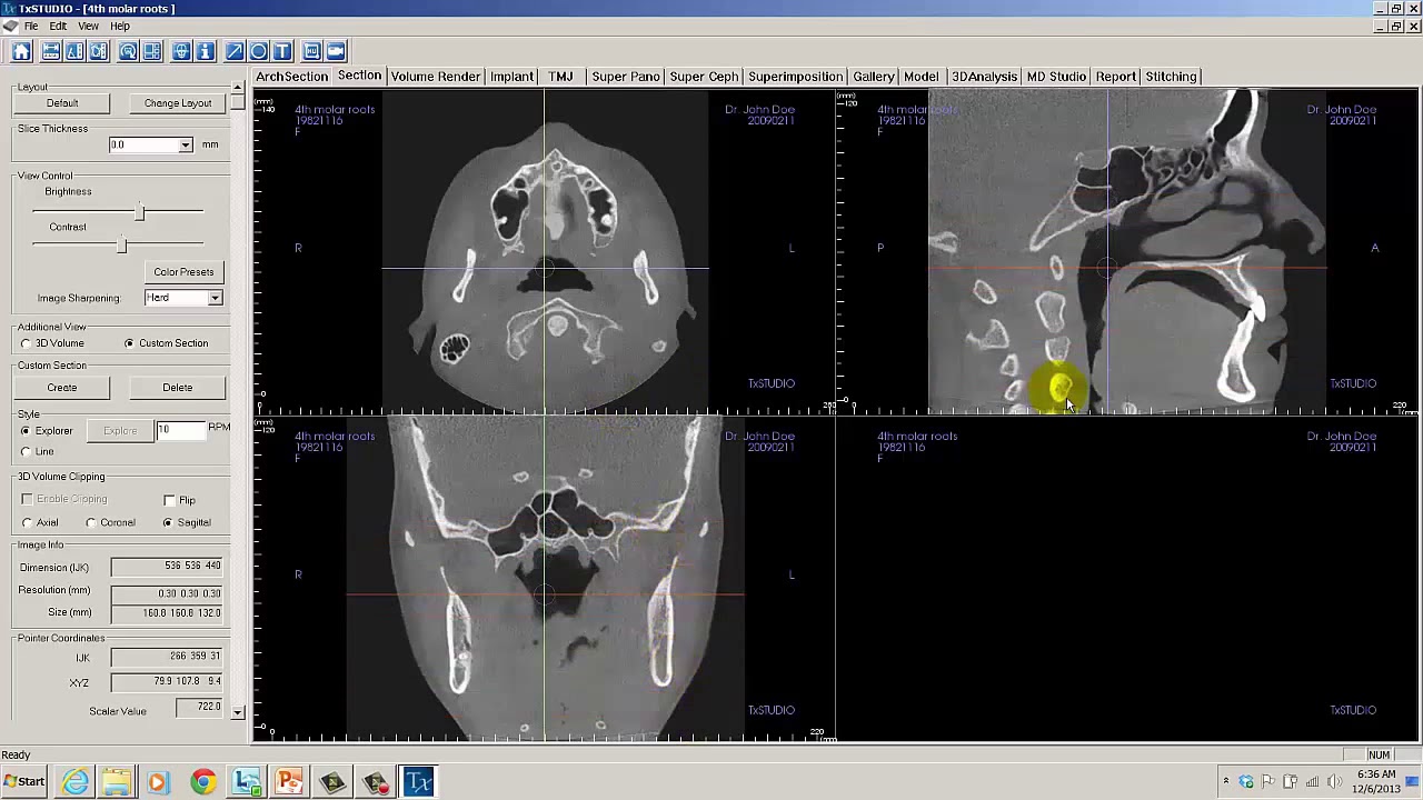 i-CAT™ Tx STUDIO™ for Beginners Tutorial - YouTube