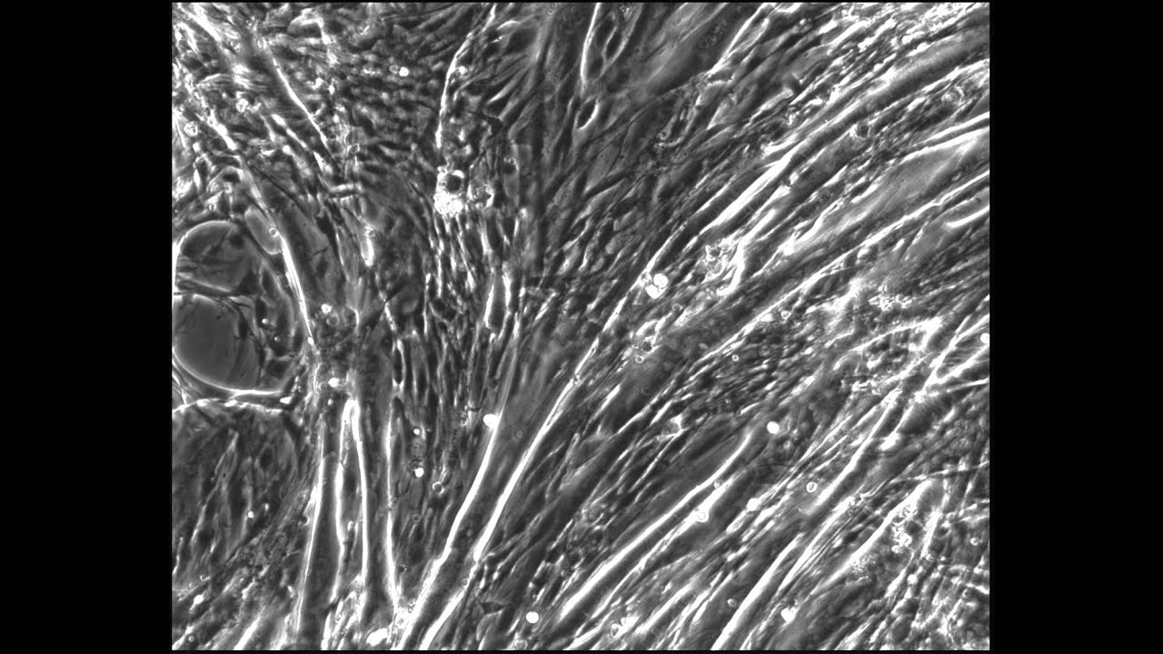 C2C12 muscle cell contractions Part II - YouTube
