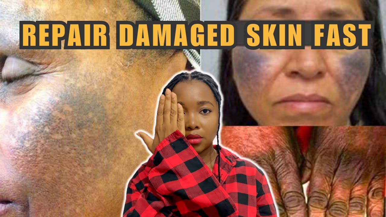 repair damaged bleached skin fast - YouTube