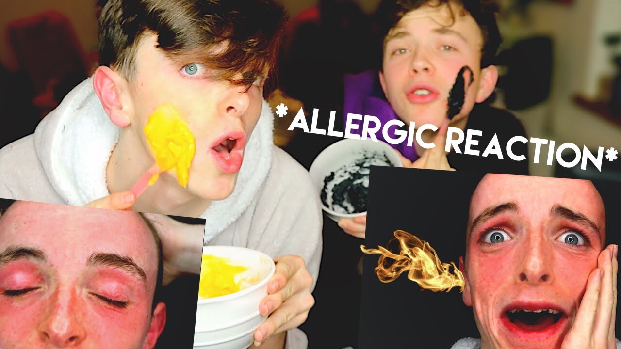 KOREAN FACE MASK HORRIFIC REACTION!!! *burned my face* - YouTube