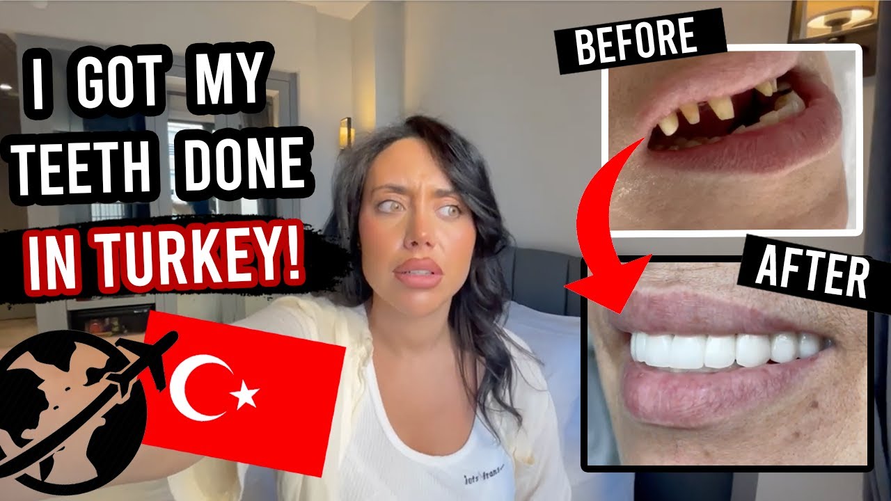 I GOT MY TEETH DONE IN TURKEY! - YouTube