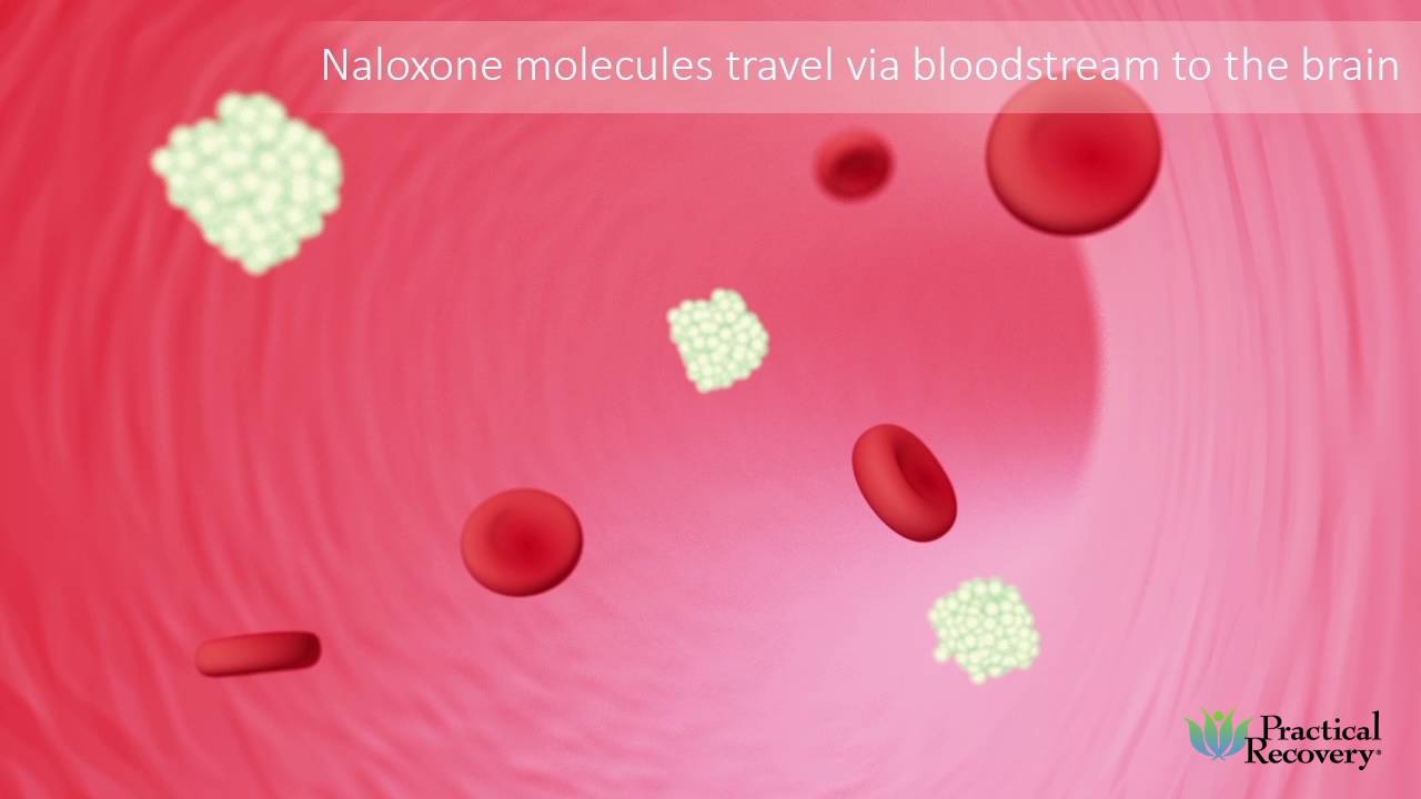 Opiate Overdose and Naloxone: Signs of Overdose and How Naloxone Works ...