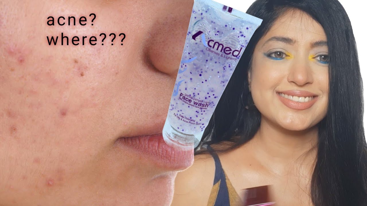 Pimple Care For Acne Prone Skin Acmed Face Wash | RUTUMA - YouTube