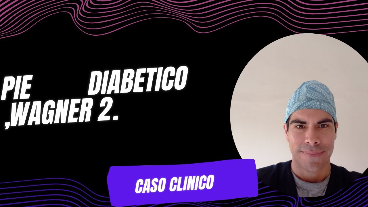 PIE DIABETICO,CLASIFICACION DE WAGNER. - YouTube